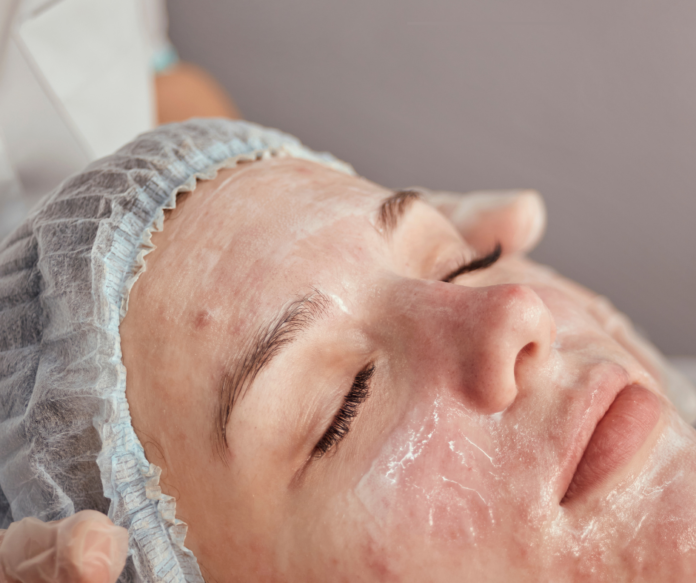 Acne Scabs Treatment: How to Get Rid of Scarring - Lulu Beauty Spa