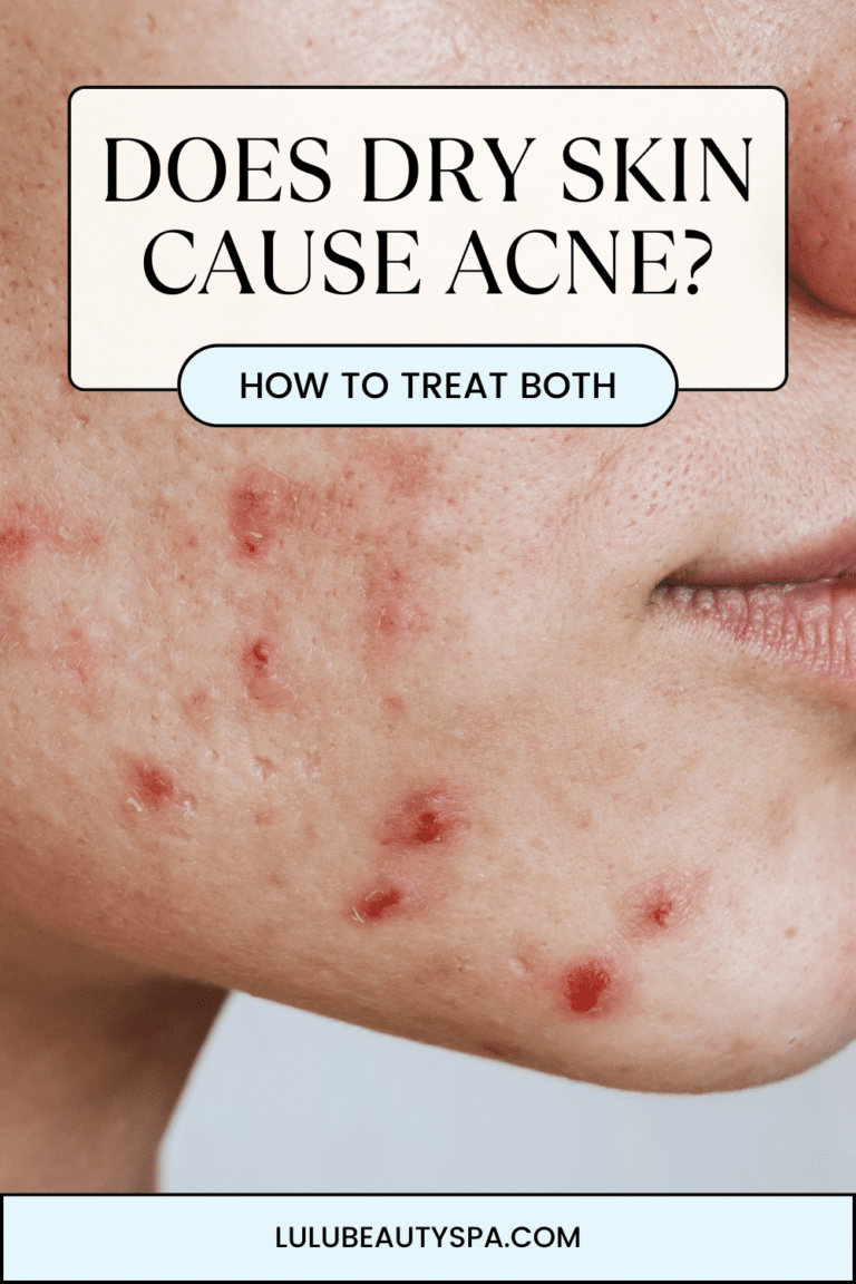 Does Dry Skin Cause Acne? How to Treat Both at the Same Time - Lulu ...